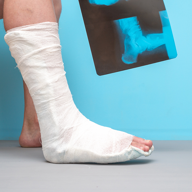 Bombay Orthopaedic Society - Official website of Bombay Orthopaedic Society